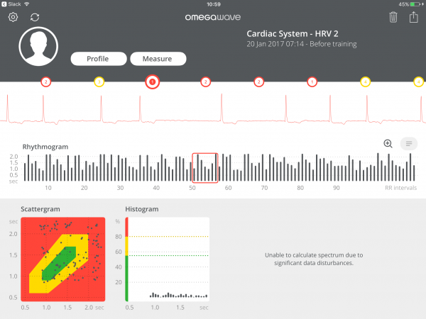 Pre-empting severe cardiac issues with Omegawave - A case study – Omegawave