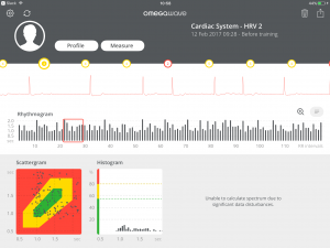 Pre-empting severe cardiac issues with Omegawave - A case study – Omegawave