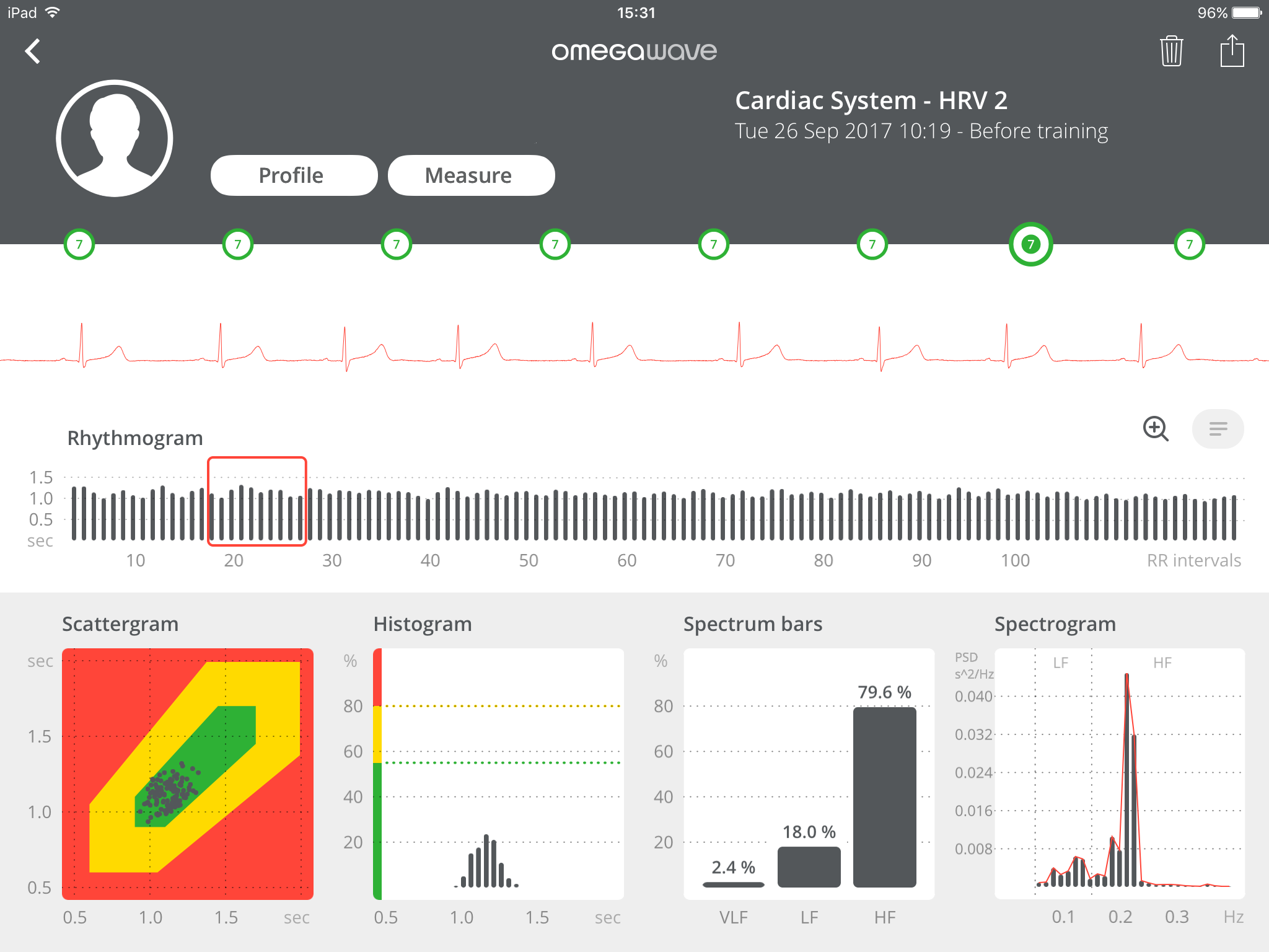 Pre-empting severe cardiac issues with Omegawave - A case study – Omegawave